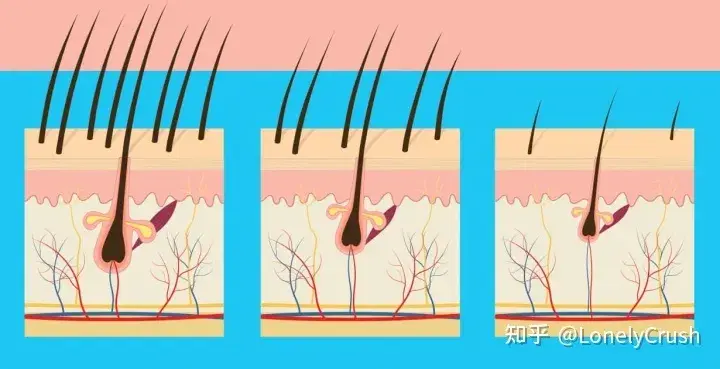 Achieve Hormonal Balance with Saw Palmetto Powder - XAZB